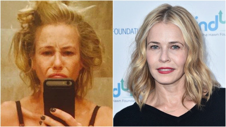 Lookism: Before & After Pics—celebrity makeup & cosmetic surgery.